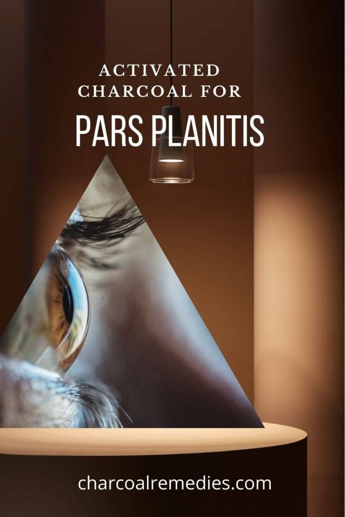 Pars Planitis - Charcoal Remedies