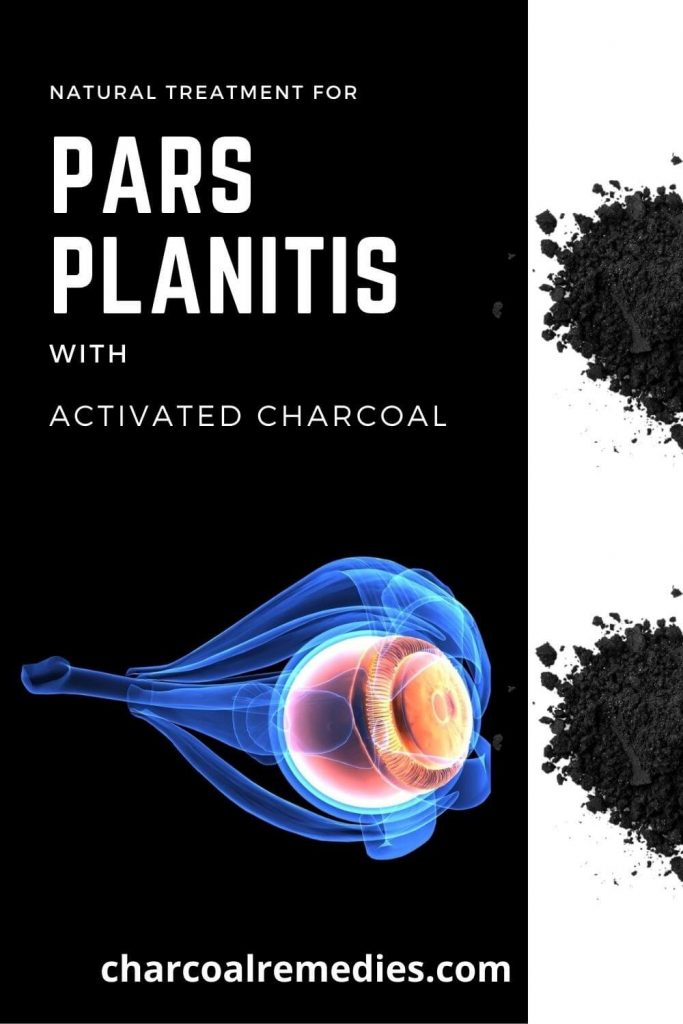 Pars Planitis - Charcoal Remedies