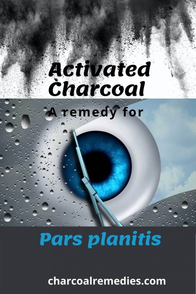 Pars Planitis - Charcoal Remedies