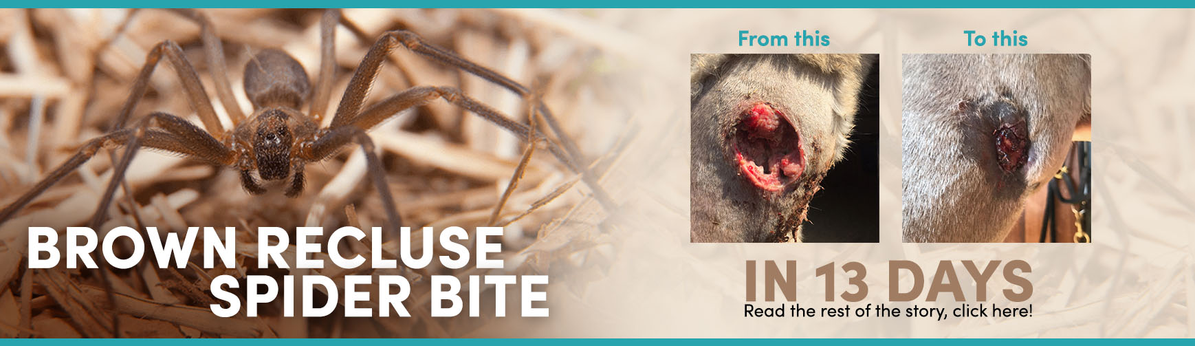 Brown Recluse Spider Bite – Charcoal Remedies